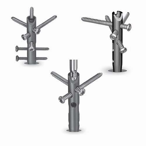 Interlocking Nailing System - Siora Surgicals Private Limited