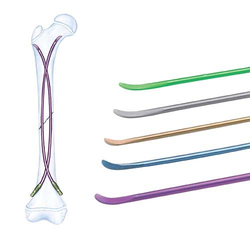 Interlocking Nailing System - Siora Surgicals Private Limited