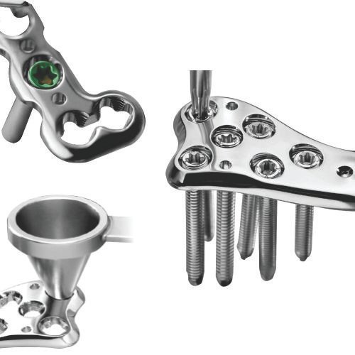 Locking Plate System - Siora Surgicals Private Limited
