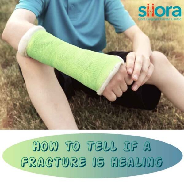 Fracture Healing Signs - A Quick Guide - Siora Surgicals Pvt. Ltd.