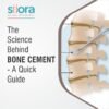 Bone Cement - A Quick Guide to the Science Behind It - Siora Surgicals ...