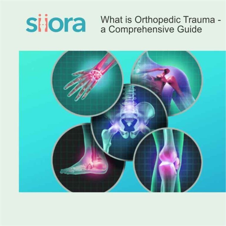 Orthopedic Trauma - A Comprehensive Guide - Siora Surgicals Pvt. Ltd.
