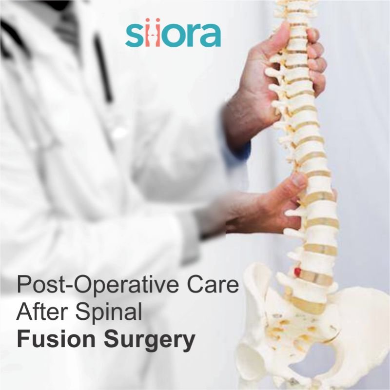 Bone Cement A Quick Guide To The Science Behind It Siora Surgicals