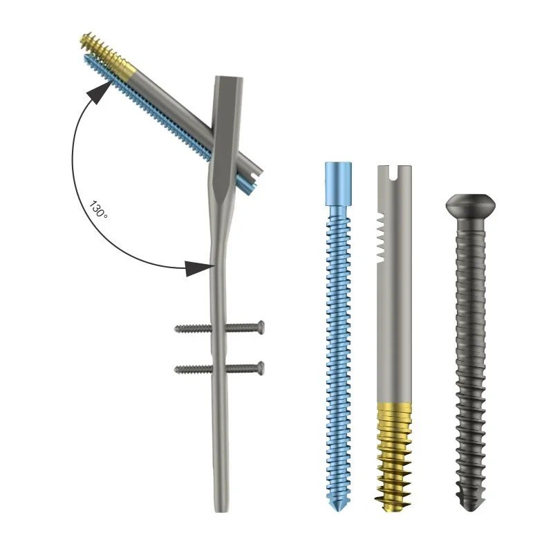 Durofix Intertan Nailing System | Siora Surgicals | Manufacturer