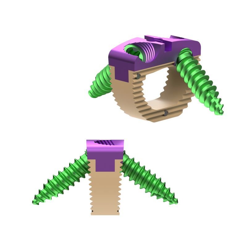 ACDF Standalone Cage PRO 7° Deg. Taper - Peek (Sterile) - Siora ...